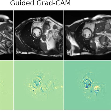 Guided Grad Cam Results For Predicting Cad On Test Images The Most Download Scientific Diagram