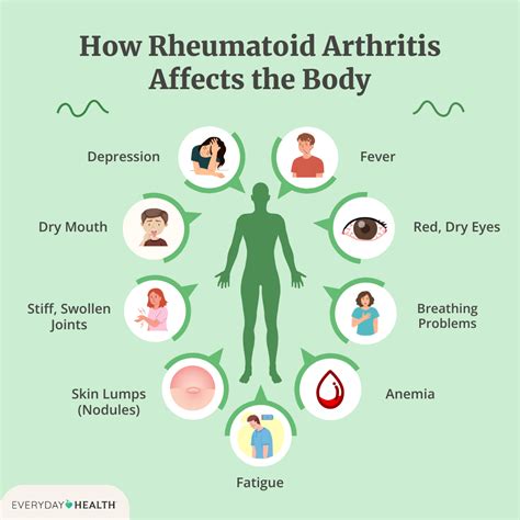 Rheumatoid Arthritis Disease Progression An Overview