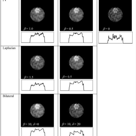 Computer Generated Phantom Reconstructed With Greens One Step Late Download Scientific Diagram