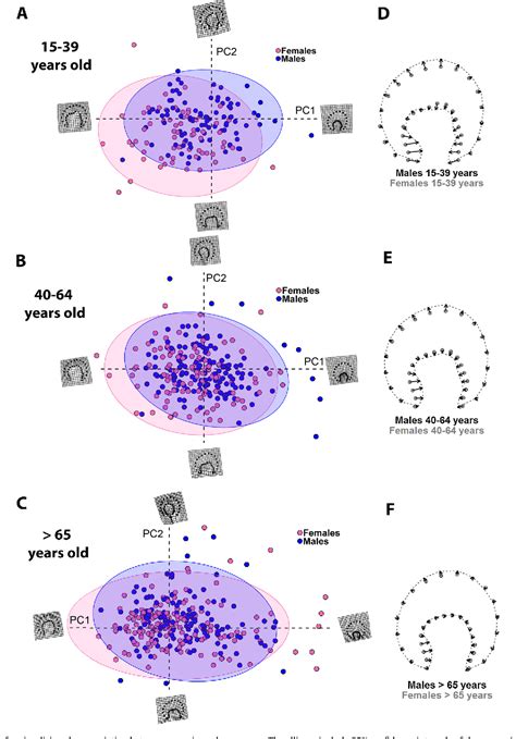 Structure Of Acetabular Fossa Semantic Scholar