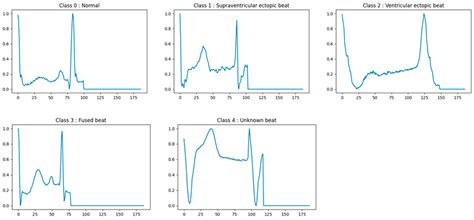 Spectrogram-Based Arrhythmia Classification Using Three-Channel Deep ...