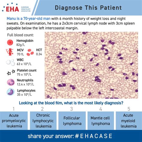 European Hematology Association On Twitter Welcome To Ehacase This