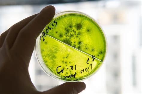 Popular Medicinal Mushrooms The Beneficial Effects Of The Lions Mane