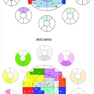 Octopus Visual Field Regions Generated By Factor Analysis Download Scientific Diagram