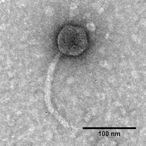 Transmission Electron Micrograph Tem Of Phage Suso Phage Particles