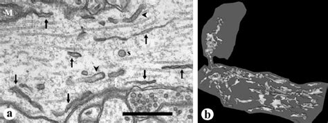 Figure 1 From Dendrite Structure Semantic Scholar