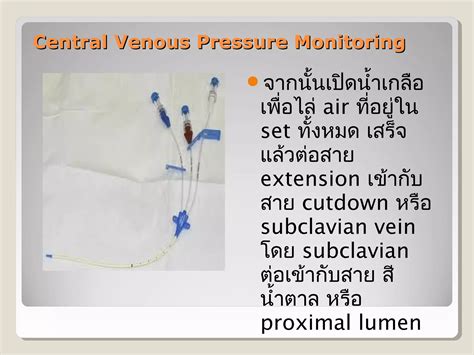 Cvp Central Venous Pressure Monitoring Ppt