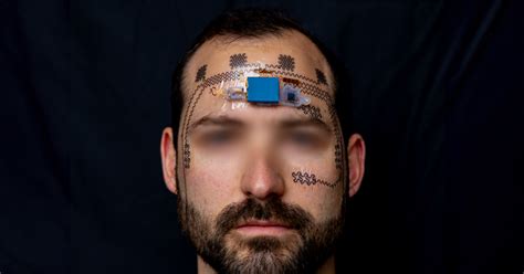 Cómo Es El Tatuaje Electrónico Que Se Coloca En La Frente Y Podría