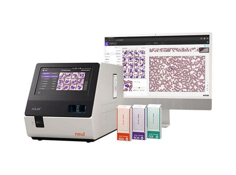 Noul Blog Nrbc Blood Test Why Accurate Detection Is Critical And How
