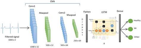Detection Of Myocardial Infarction Using Hybrid Models Of Convolutional Neural Network And