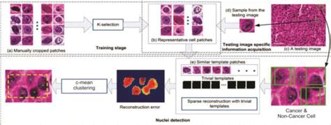 Figure 3 From Clustering Technique For Brain Tumor Detection In Mr Images Semantic Scholar