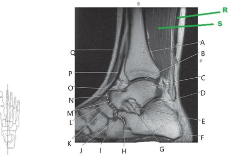 Sagittal T1 Weighted Mri Of Ankle Ligaments And Tendons Diagram Quizlet