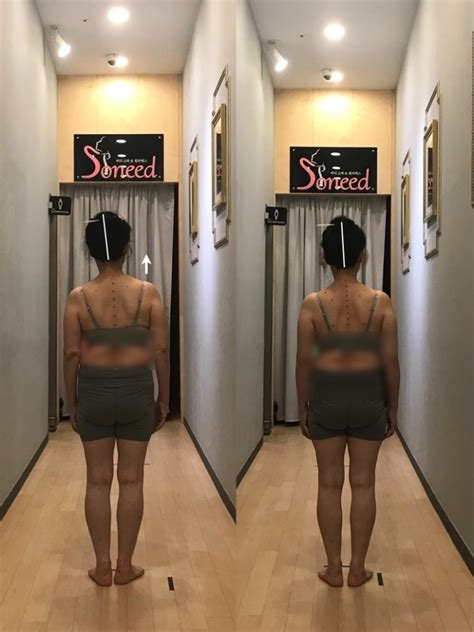 동탄 체형교정 60대 통증관리 소니드 네이버 블로그