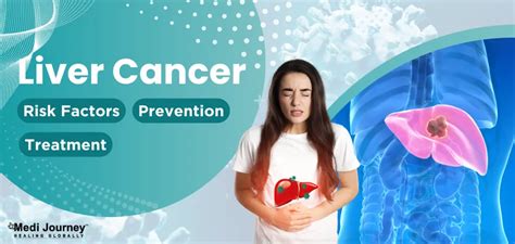 Liver Cancer Understanding Risk Factors Prevention And Treatment