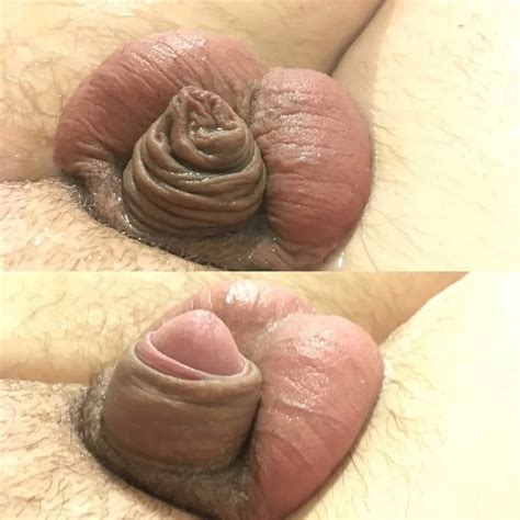 My Micropenis 3 Pics Xhamster