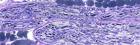 Nerves Light Micrograph Stock Image C024 8095 Science Photo Library