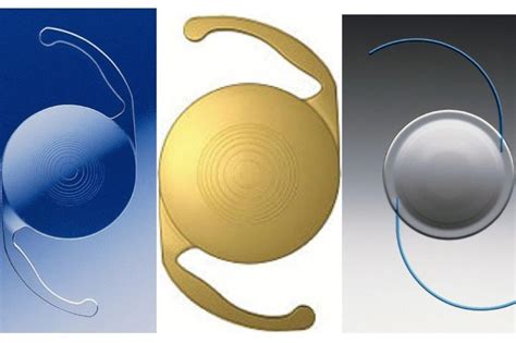 Successful Public Hospital Multifocal Iol Pathway