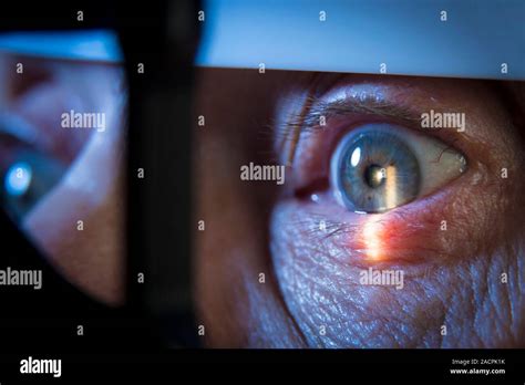 Slit Lamp Eye Examination Close Up Of The Eyes Of A Patient Undergoing