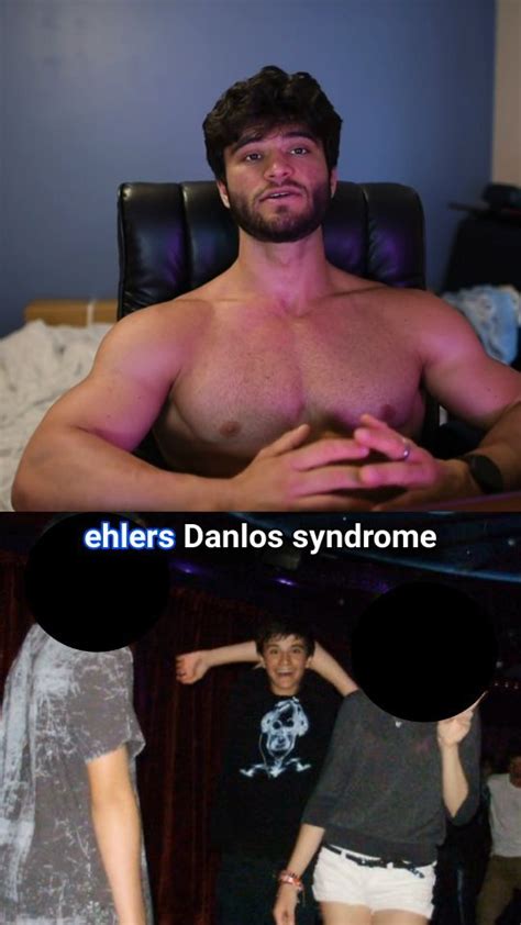 Aaron Spira Injury Recovery And Bodybuilding Thejointcoach