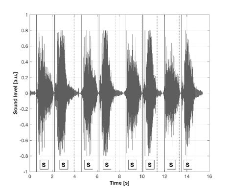 Sample Of Acoustic Snoring Signal Recorded During Sleep With Segments Download Scientific