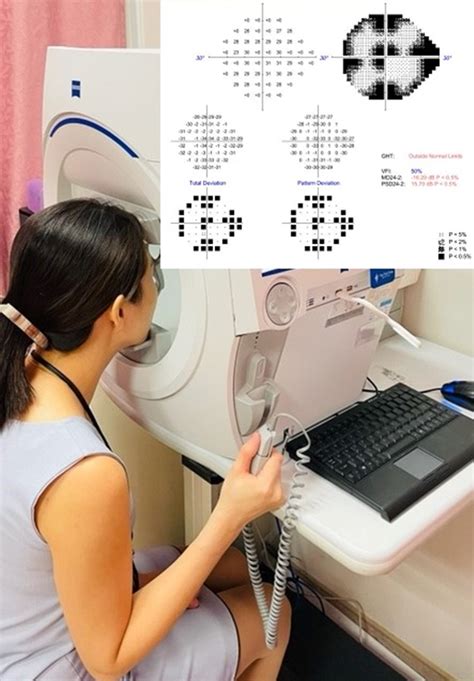 Normal Peripheral Vision Test Results For Singapore