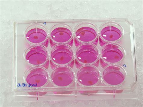 Time Lapse Confocal Imaging Of Migrating Neurons In Organotypic Slice Culture Of Embryonic Mouse