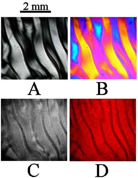 Patterns Of Microtubule Orientation And Concentration Coincide With