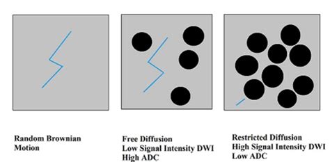 Dynamic Contrast Magnetic Resonance Imaging Dce Mri And Diffusion