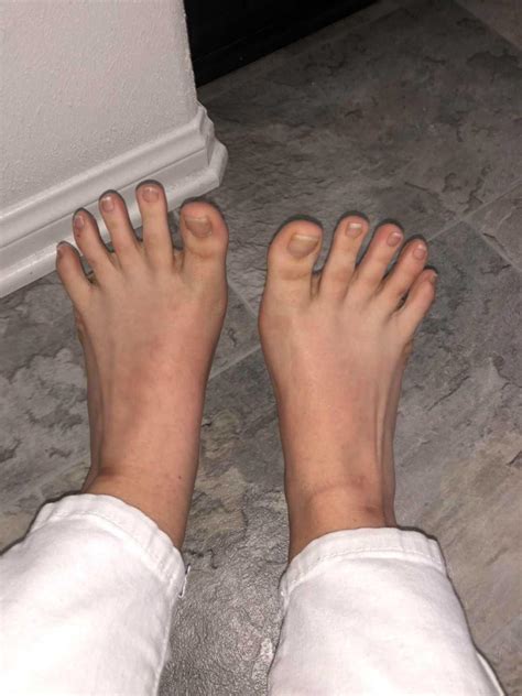 Sweaty Milf Soles😉 R Longtoesfetish