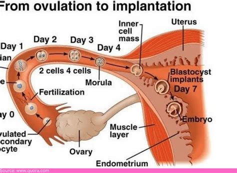 Can A Late Implantation After Frozen Embryo Transfer Result In A