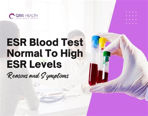 Esr Blood Test Normal Range High Esr Causes And Symptoms Explained