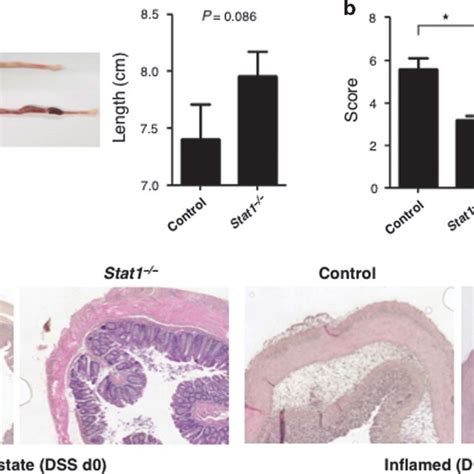 Identification Of Colitogenic Macrophages During Colitis Development