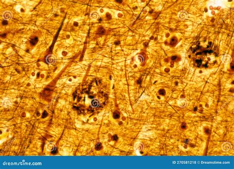 Human Cerebral Cortex Pyramidal Neuron Lipofuscin Royalty Free Stock