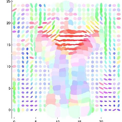 Figure Perona Malik Filter On A Diffusion Tensor Image Using Means On