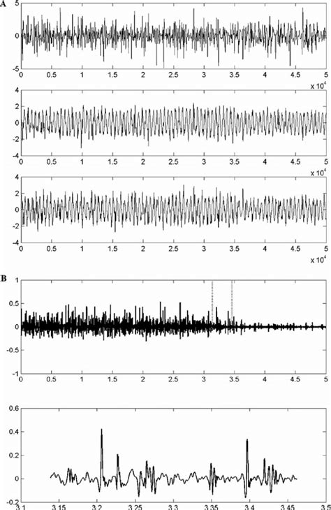 An Example Of Remove Power Interference Based On The Wavelet Filtering