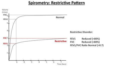 Restrictive Spirometry Graph At Gary Mckellar Blog