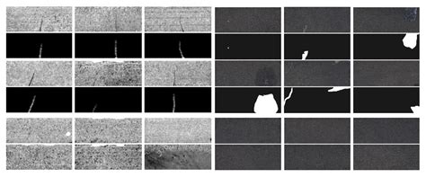 Anomalyseg Deep Learning Based Fast Anomaly Segmentation Approach For