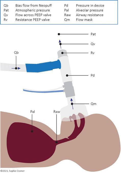 schematic visualisation of flows pressures and resistance during