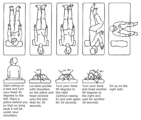 Epley Procedure At Home