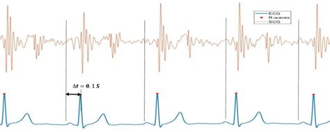 segmentation of the scg signal using ecg beats download scientific