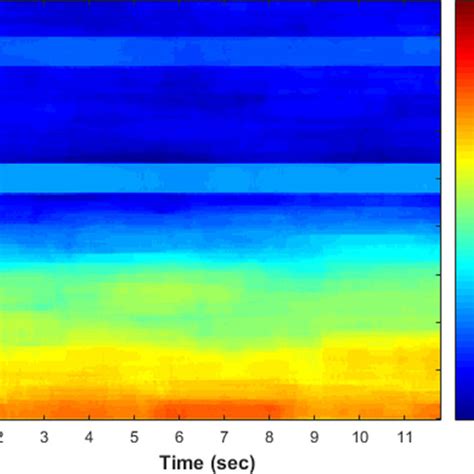 Example Of Spectrogram Extracted In A Normal Eeg Segment Download Scientific Diagram