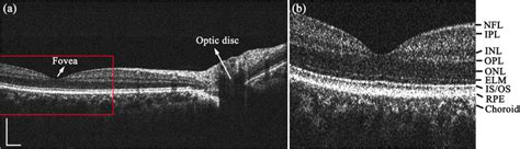 Retina Image Acquired From Retina OCT A And Magnification Of The Download Scientific Diagram