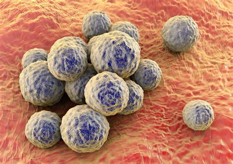 Can Ciprofloxacin Treat Staphylococcus Aureus