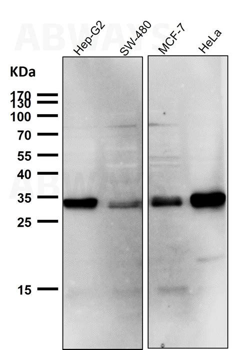 P Cdk1 2 T14 Ab Abways