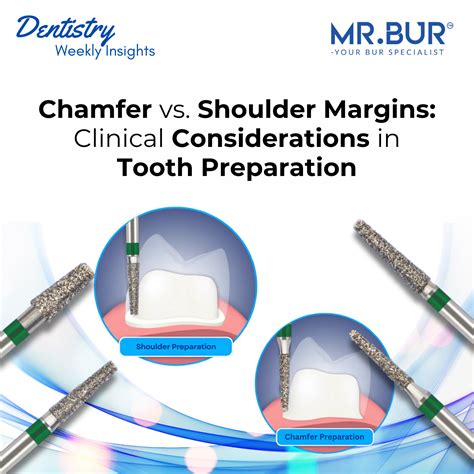 Chamfer Vs Shoulder Margins Clinical Considerations In Tooth Prepara Mr Bur
