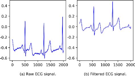 Figure 2 From A Practical Cross Domain Ecg Biometric Identification Method Semantic Scholar