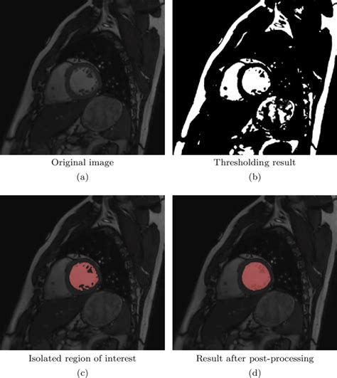 Thresholding Segmentation Download Scientific Diagram