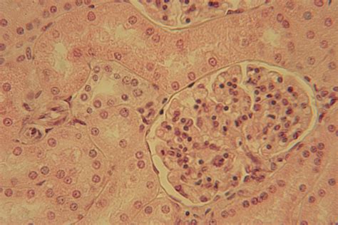 Simple Squamous 400x 2