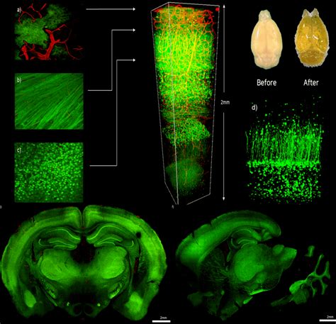 Deep Brain Imaging With Ivim Techs Cutting Edge Techniques