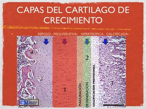 Fisiologia Y Anatomia Del Cartilago De Crecimiento